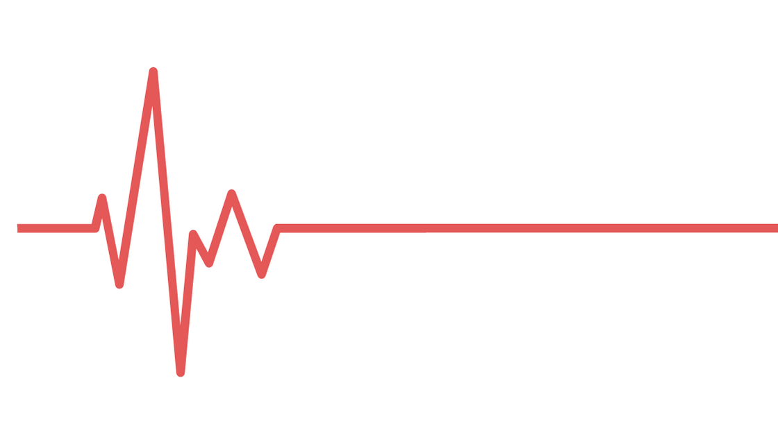 Ekg Line Png
