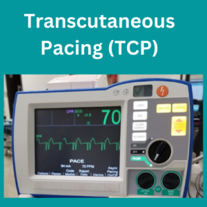 Transcutaneous Pacing (TCP) - CPR Done Right | CPR, ACLS, BLS, PALS ...