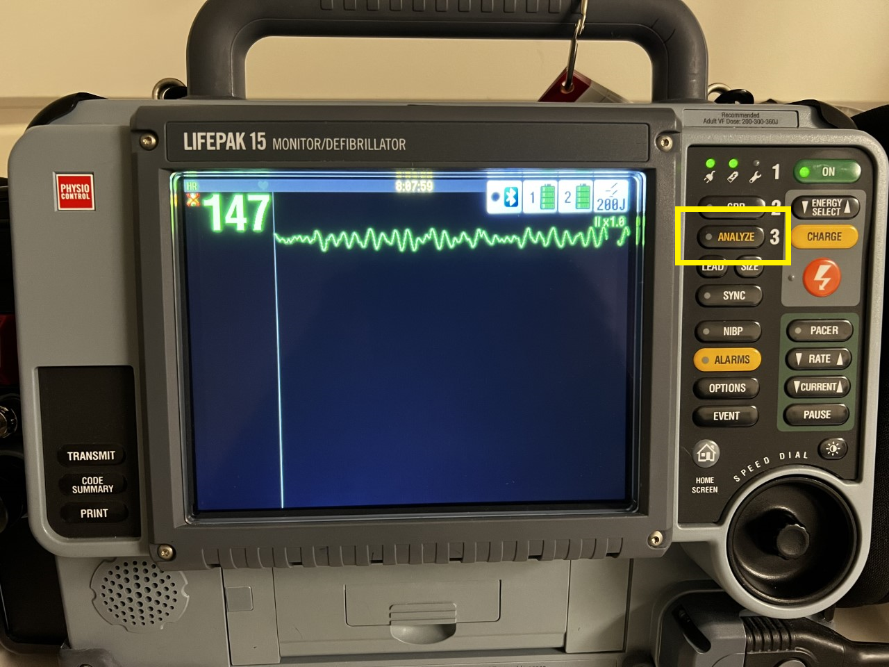AED Mode on ALS Defibrillator - CPR Done Right | CPR, ACLS, BLS, PALS ...